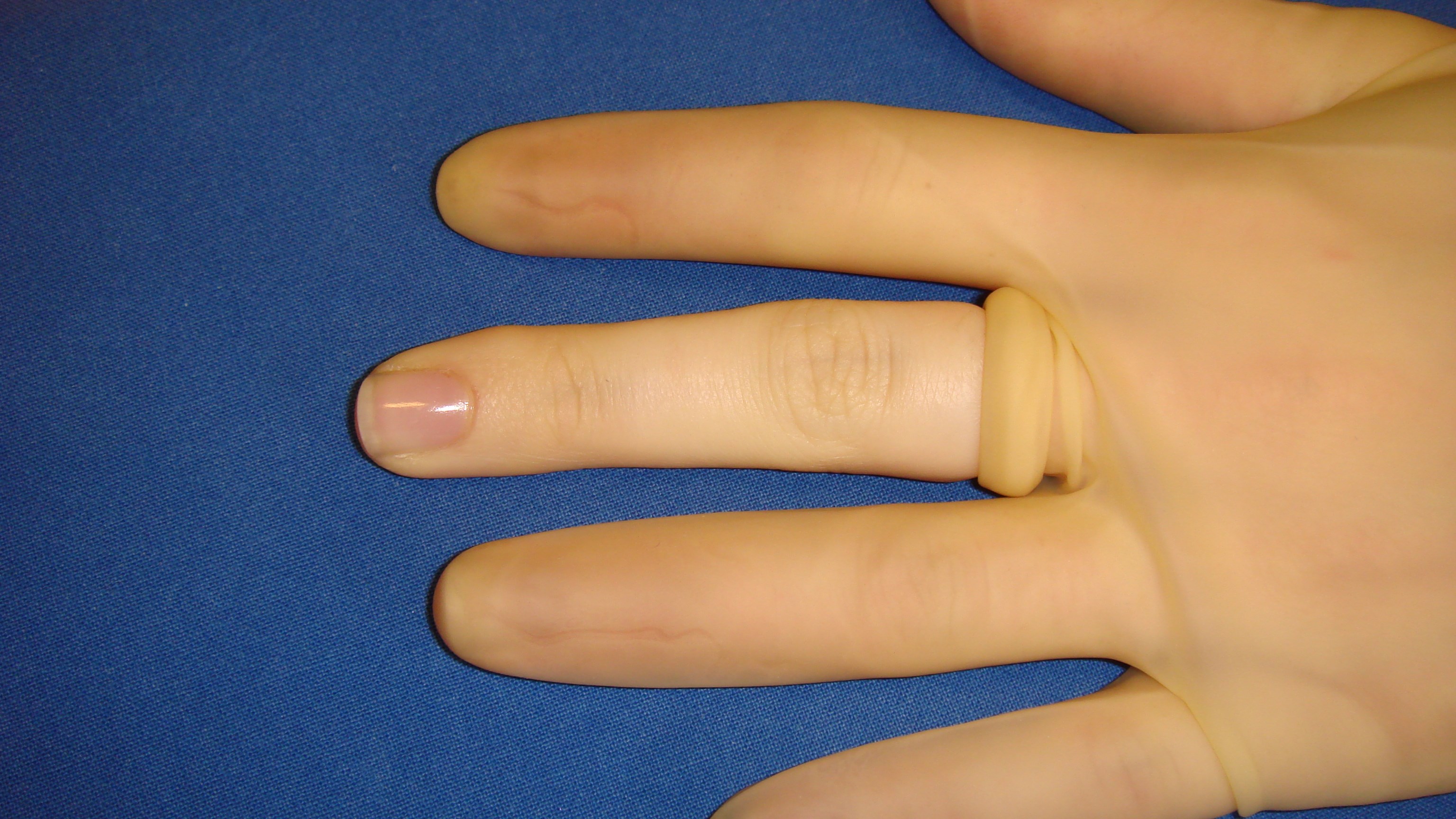 Praktiska råd och färdigheter - Sahlgrenska Universitetssjukhuset