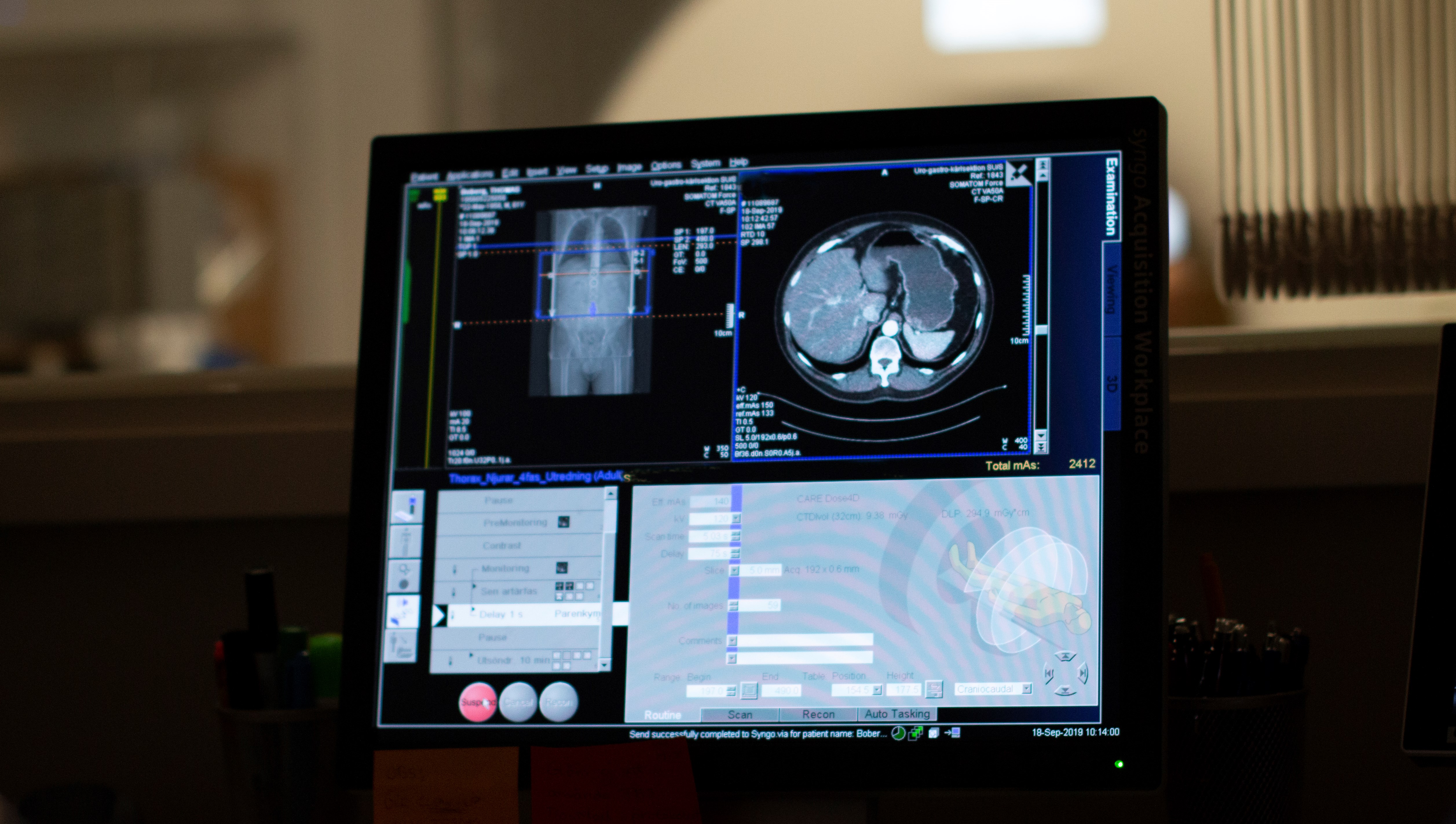 Kompetenscentrum AI – datadrivet arbete i vården - Sahlgrenska ...